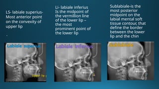 Soft tissue cephalometric analysis [Autosaved].pptx