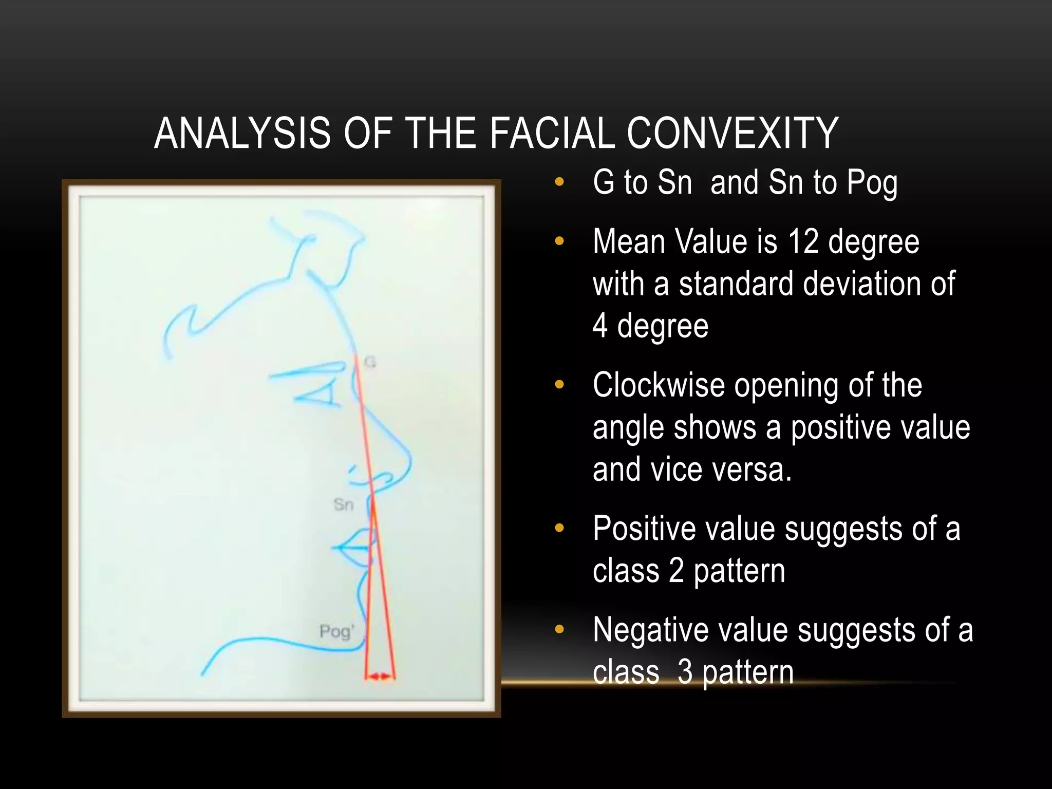 Soft tissue cephalometric analysis for orthognathic surgery | PPTX