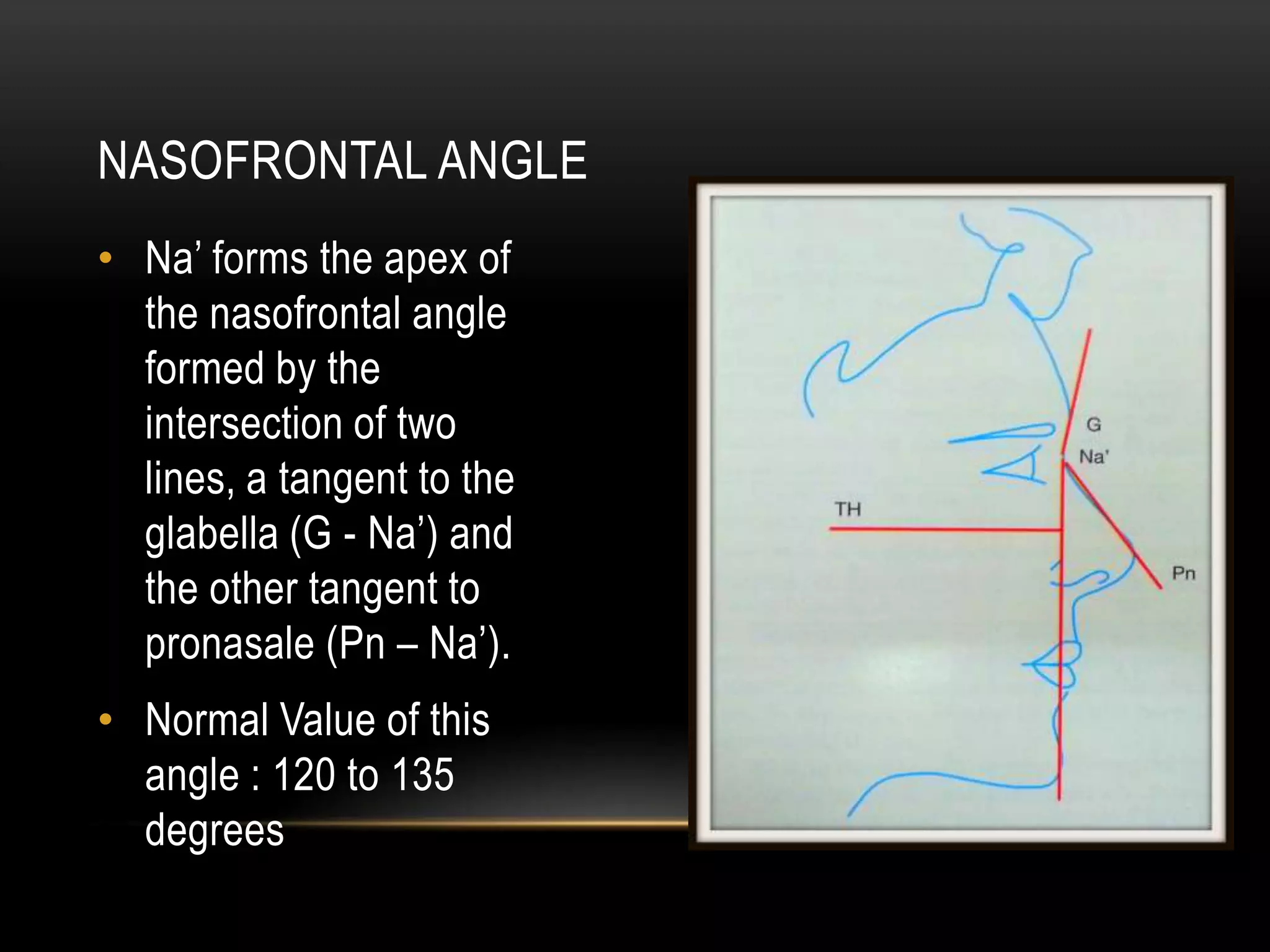 Soft tissue cephalometric analysis for orthognathic surgery | PPTX