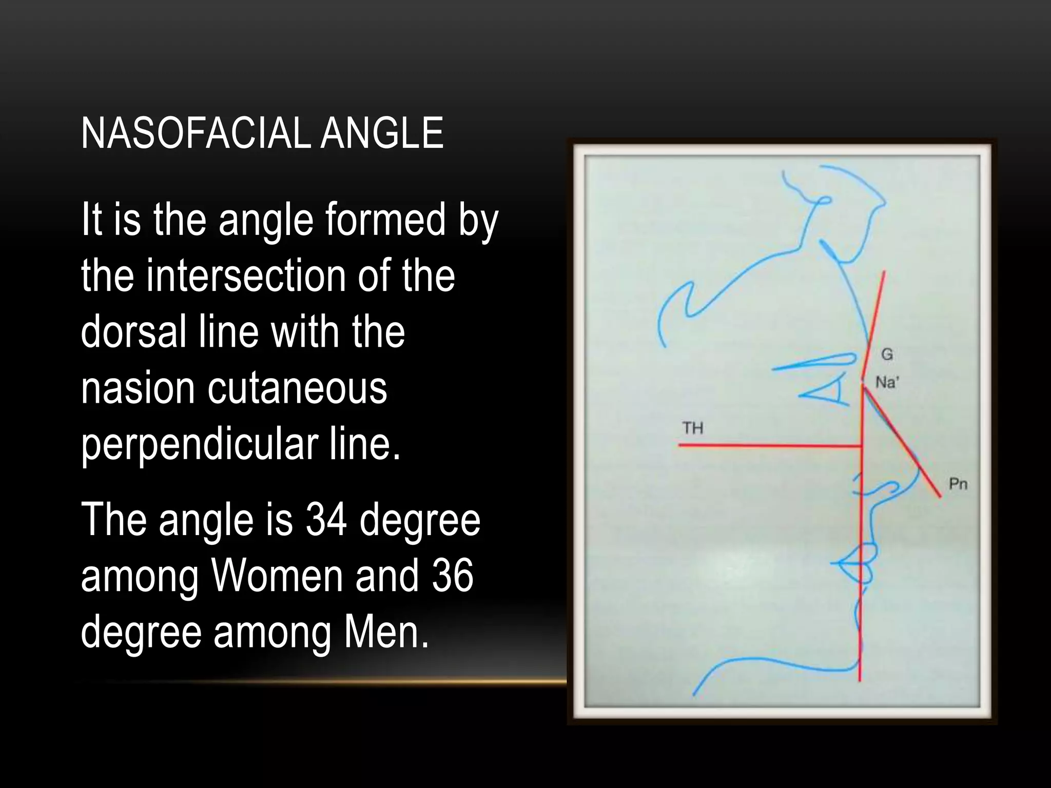 Soft tissue cephalometric analysis for orthognathic surgery | PPTX