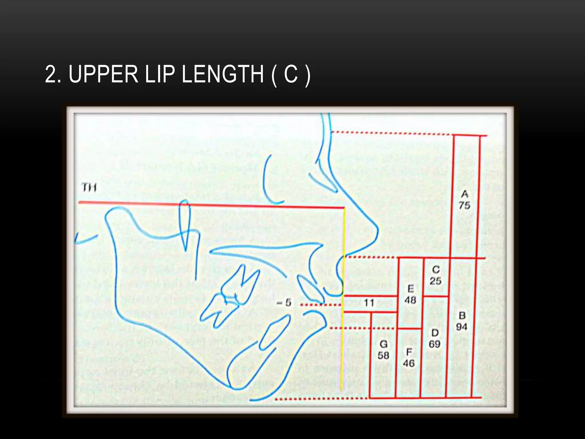 Soft tissue cephalometric analysis for orthognathic surgery | PPTX