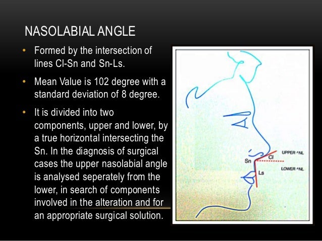 Soft tissue cephalometric analysis for orthognathic surgery
