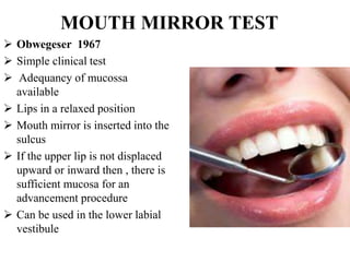 Soft tissue changes in preprosthetic surgery | PPT