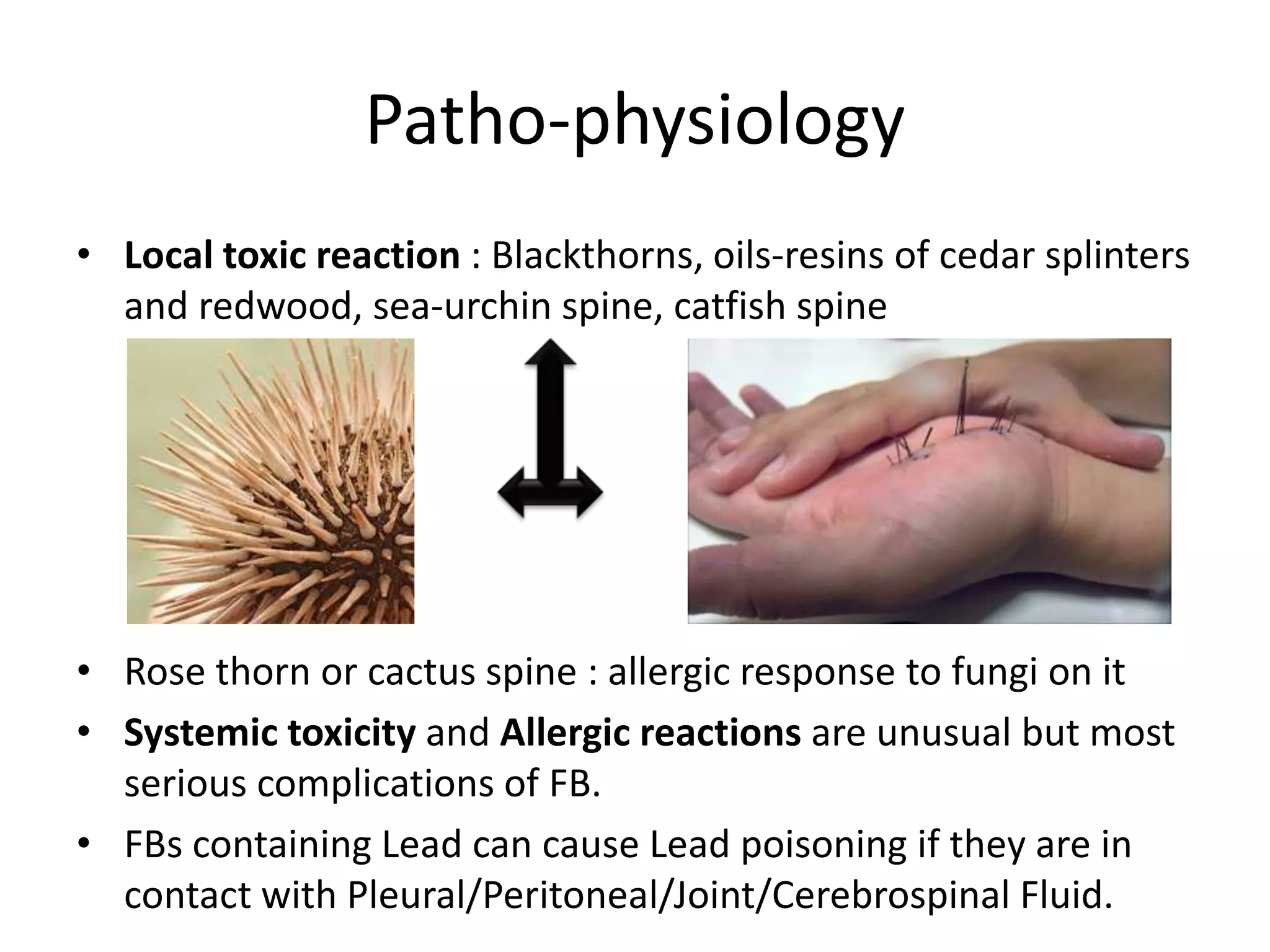 Soft tissue foreign body | PPTX