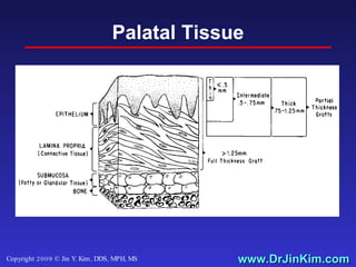 Soft Tissue Grafts Techniques | PPT