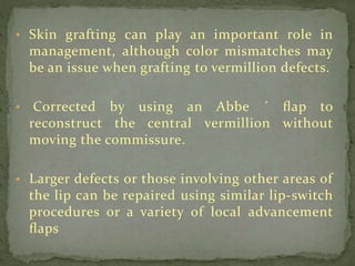 Soft tissue handling in pan facial trauma | PPTX