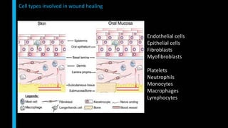 Soft tissue healing | PPTX | Biological Sciences | Science