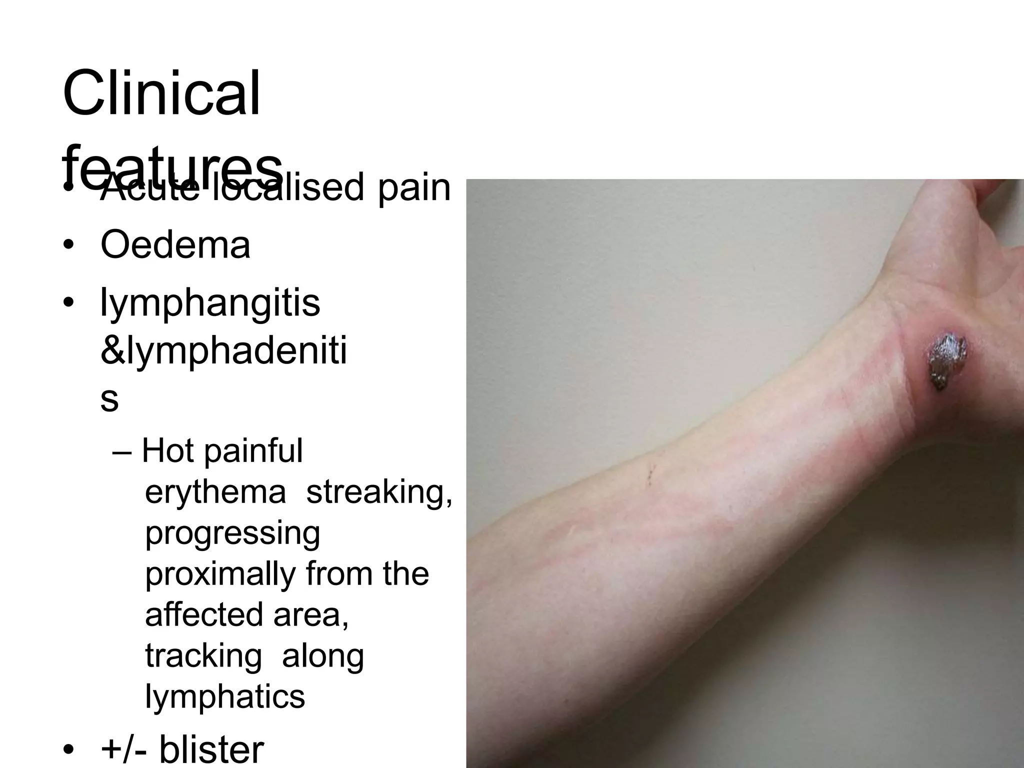 softtissueinfections.pptx