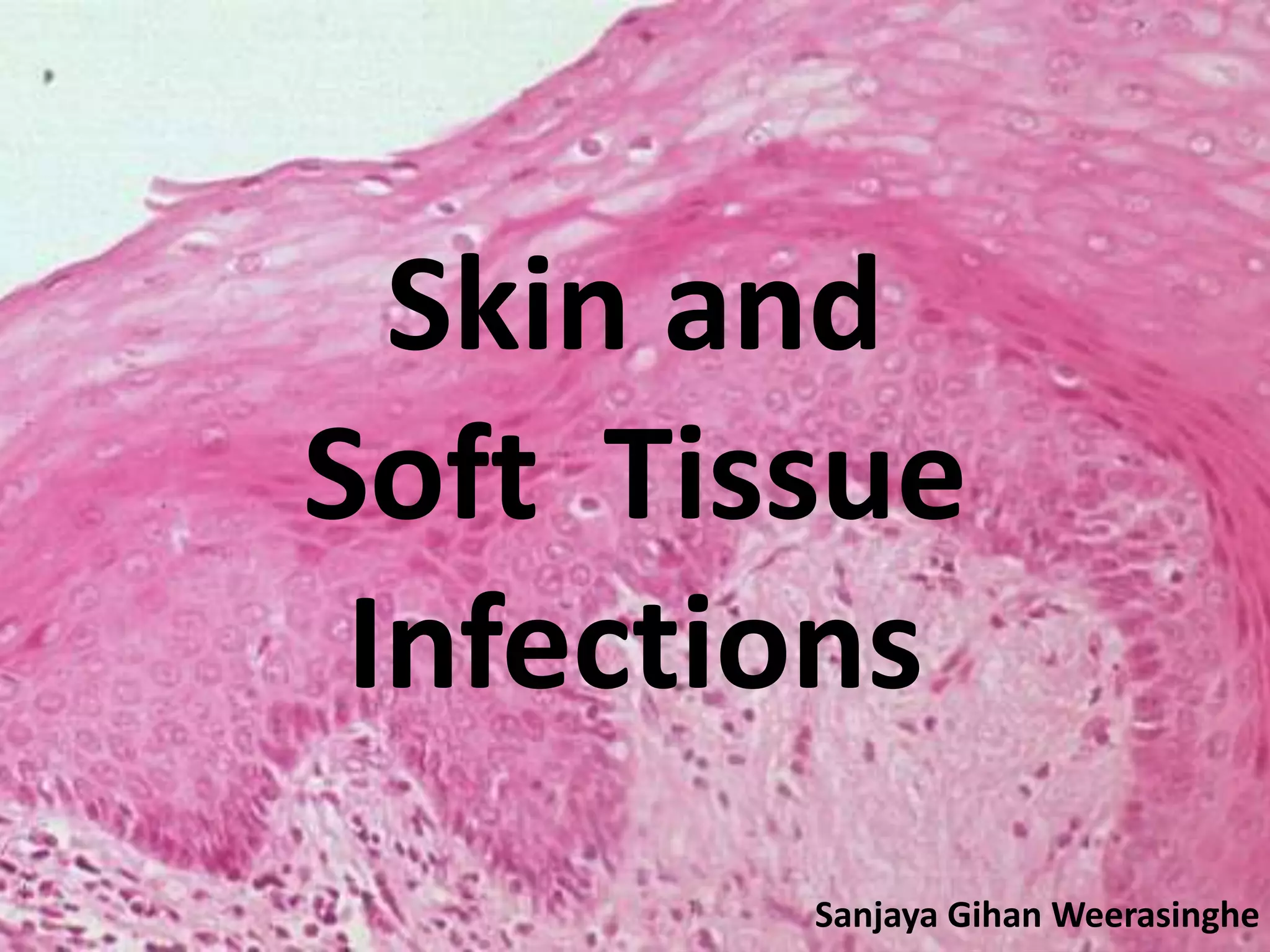 Skin and Soft tissue infections | PPTX