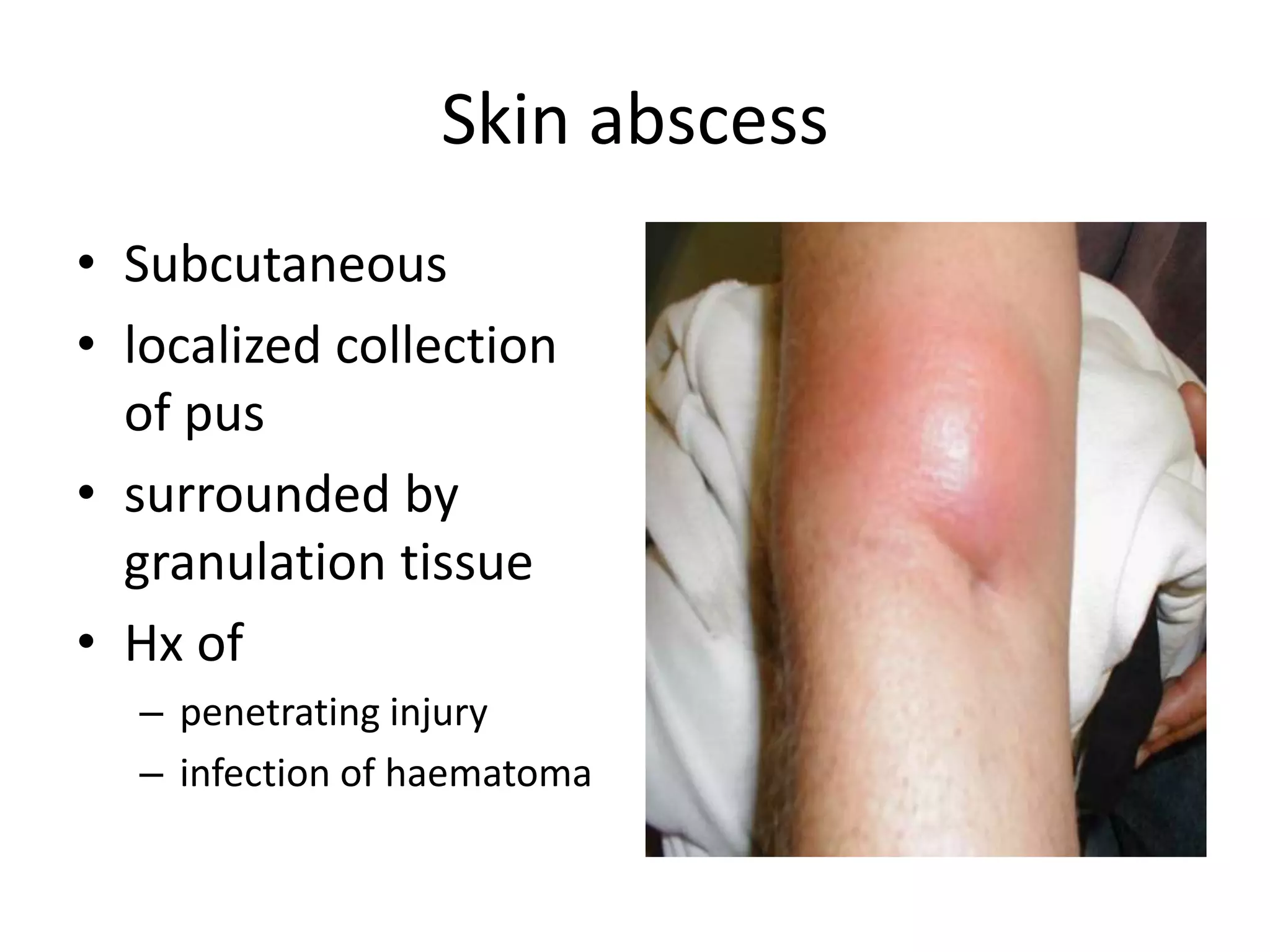 Skin and Soft tissue infections | PPTX