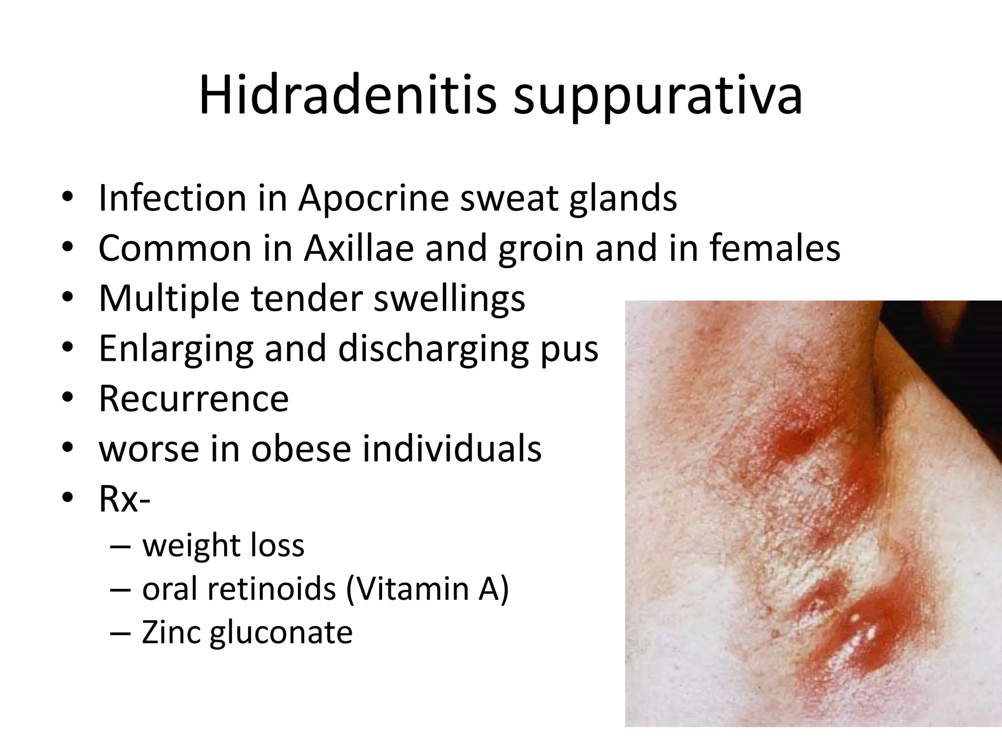 Skin and Soft tissue infections | PPTX
