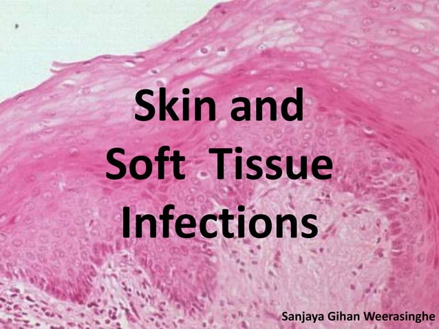 Skin and Soft tissue infections | PPTX | Skin and Dermatology | Diseases and Conditions
