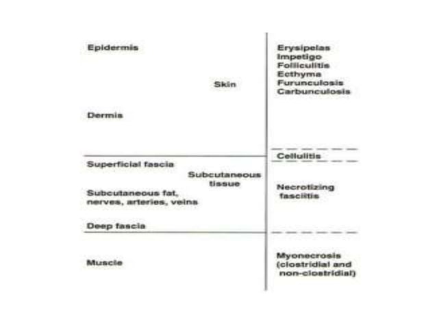 Skin and Soft tissue infections | PPTX | Skin and Dermatology | Diseases and Conditions
