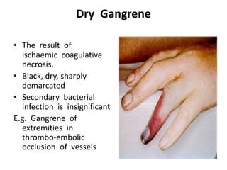 Skin and Soft tissue infections | PPTX