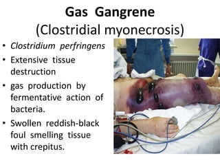 Skin and Soft tissue infections | PPTX | Skin and Dermatology ...