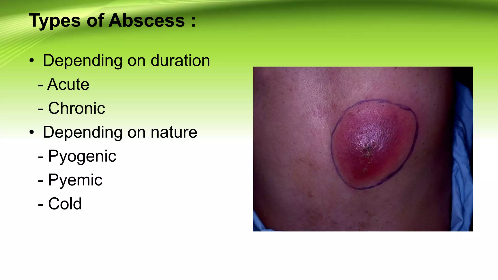 Soft tissue infections in children | PPTX