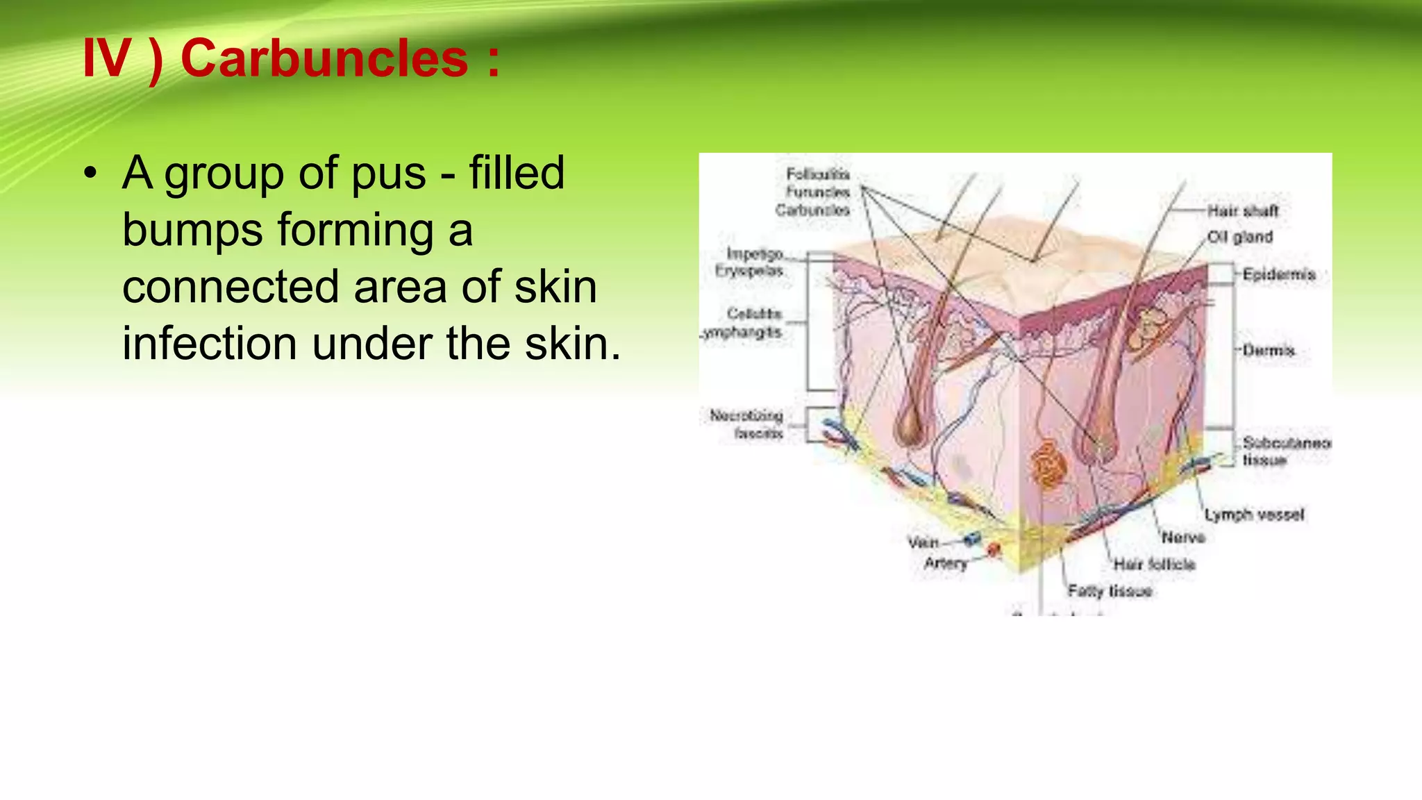 Soft tissue infections in children | PPTX