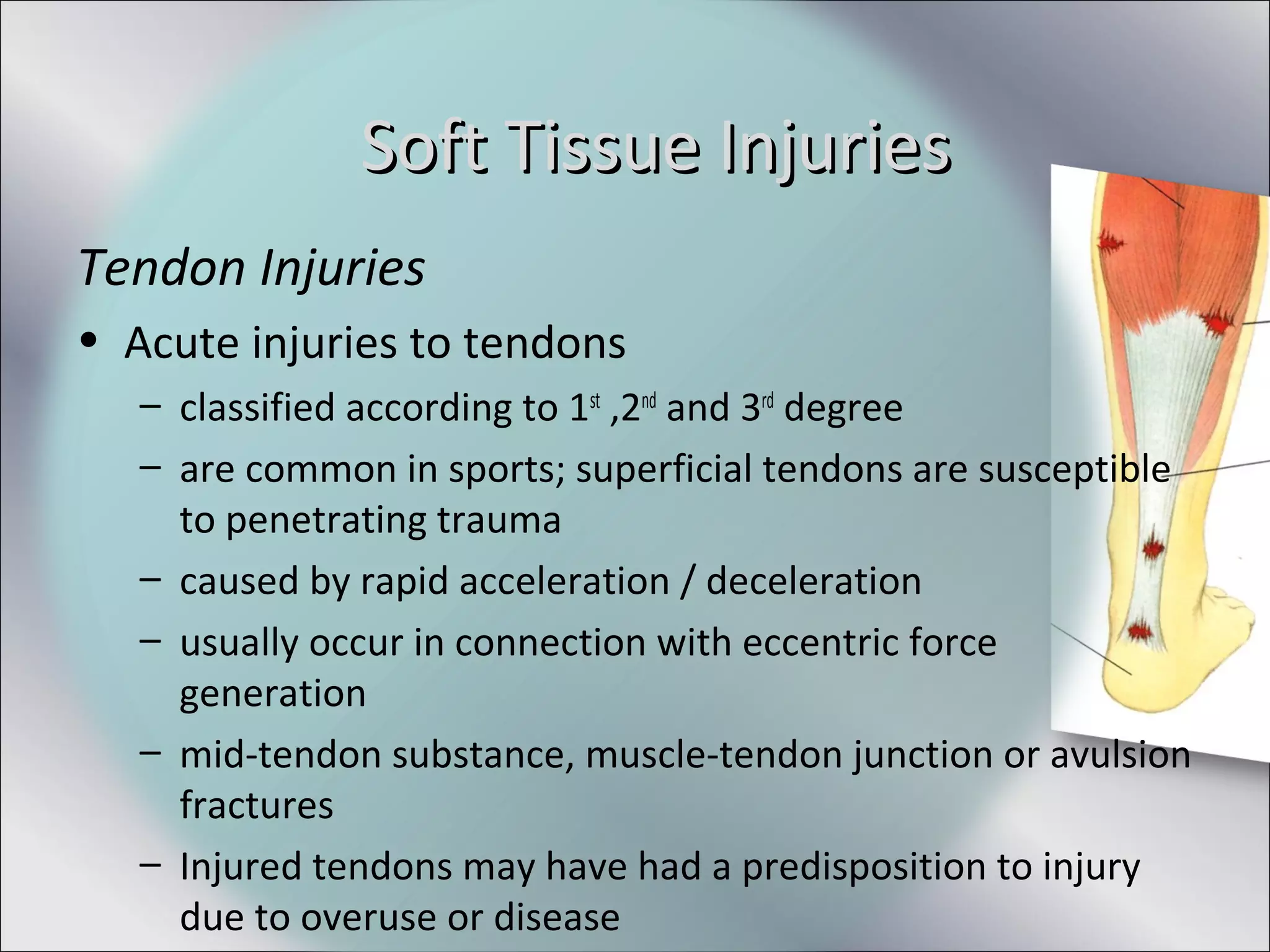 Soft tissue injuries | PPT
