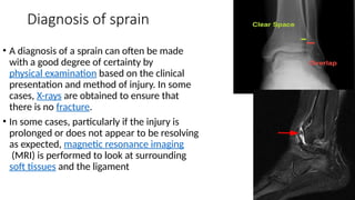 Soft Tissue Injuries - Mechanism of injury of.pptx