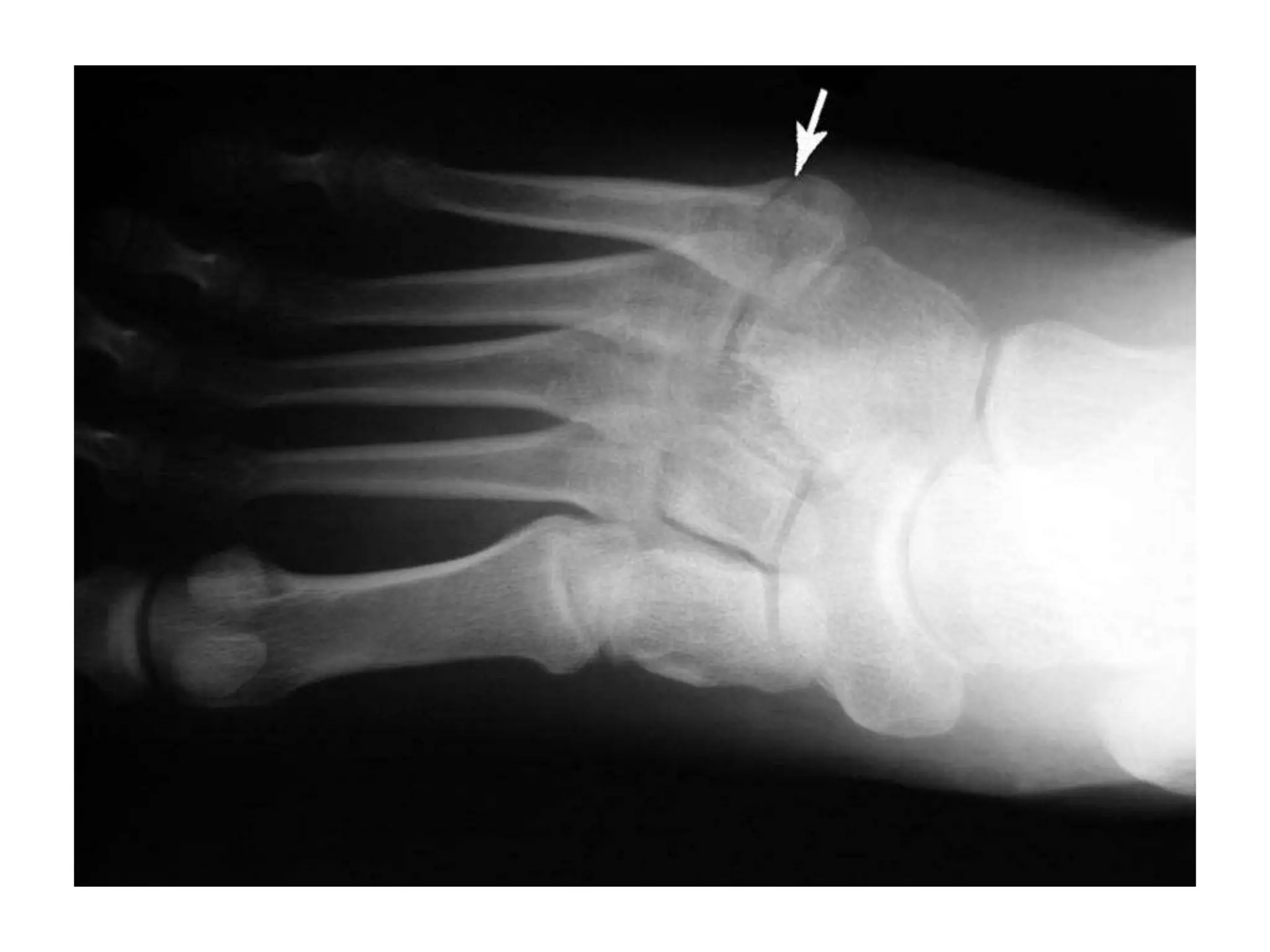 Soft Tissue Injuries of Ankle & Foot.pptx