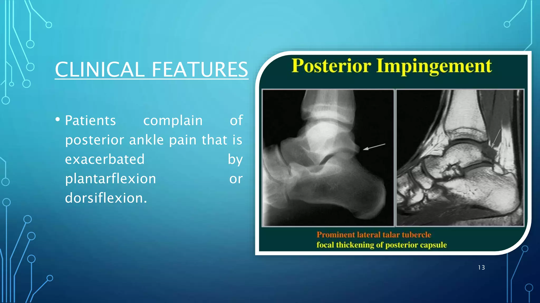 Soft Tissue Injuries Of The Ankle | PPTX