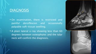 Soft Tissue Injuries Of The Ankle | PPTX