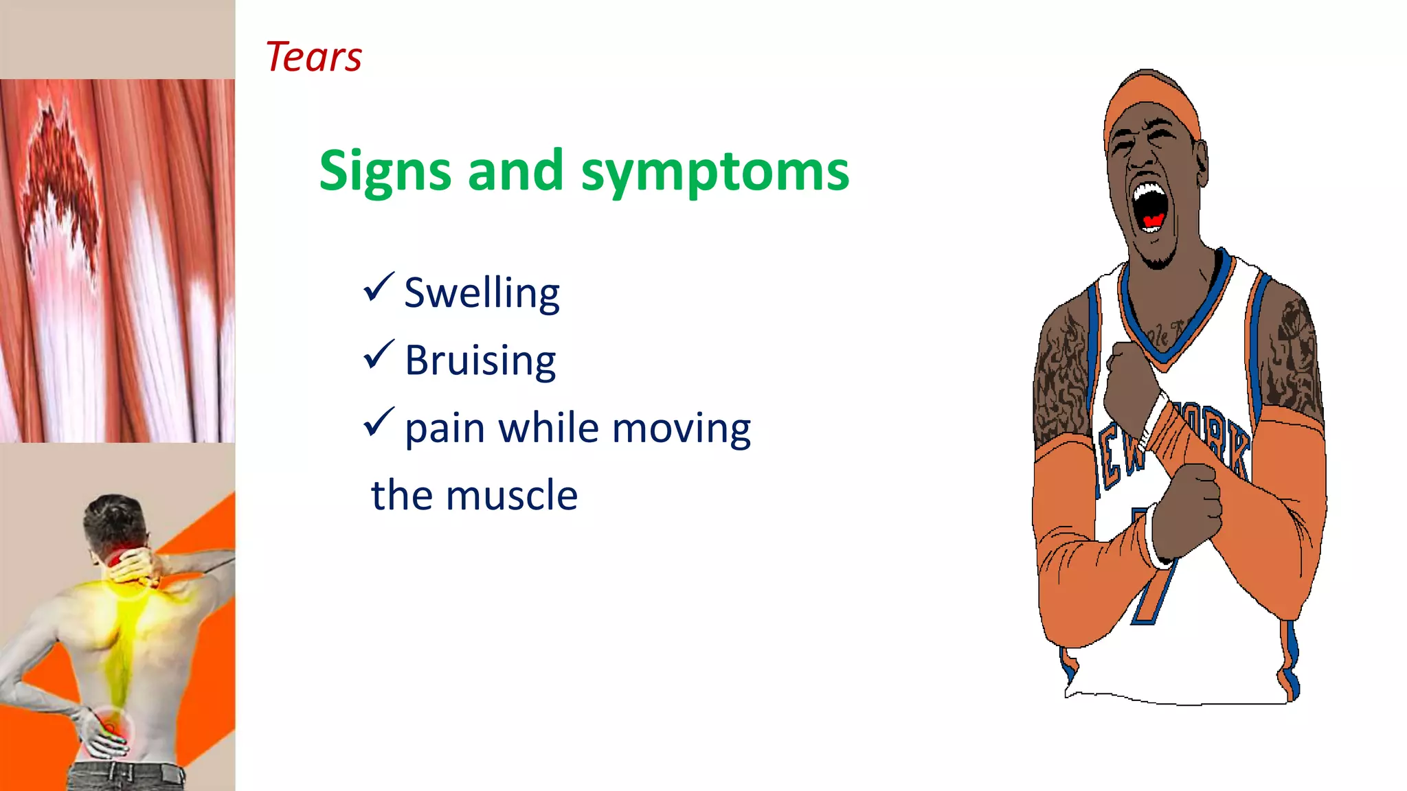 Soft tissue injuries management | PPTX
