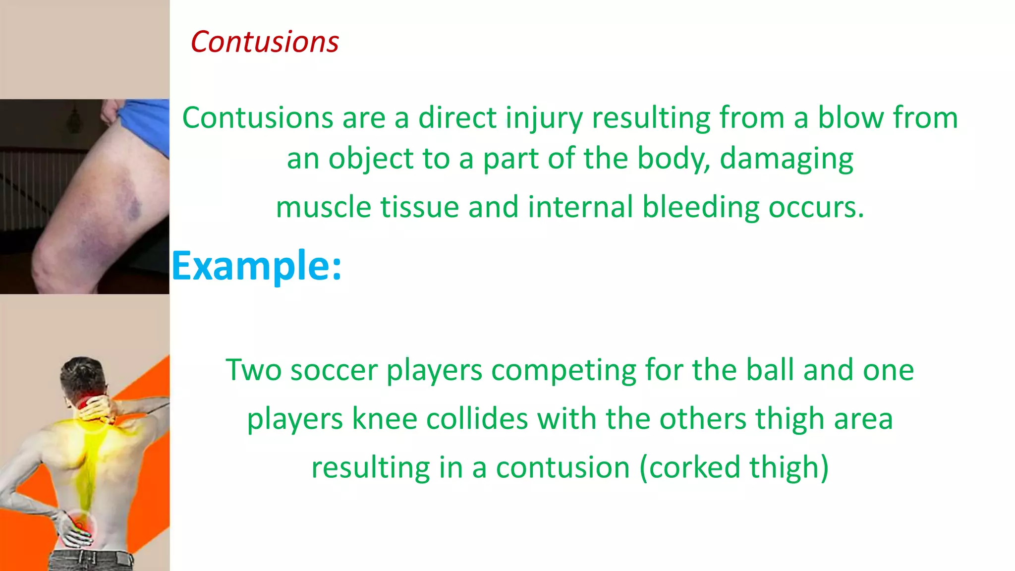 Soft tissue injuries management | PPTX