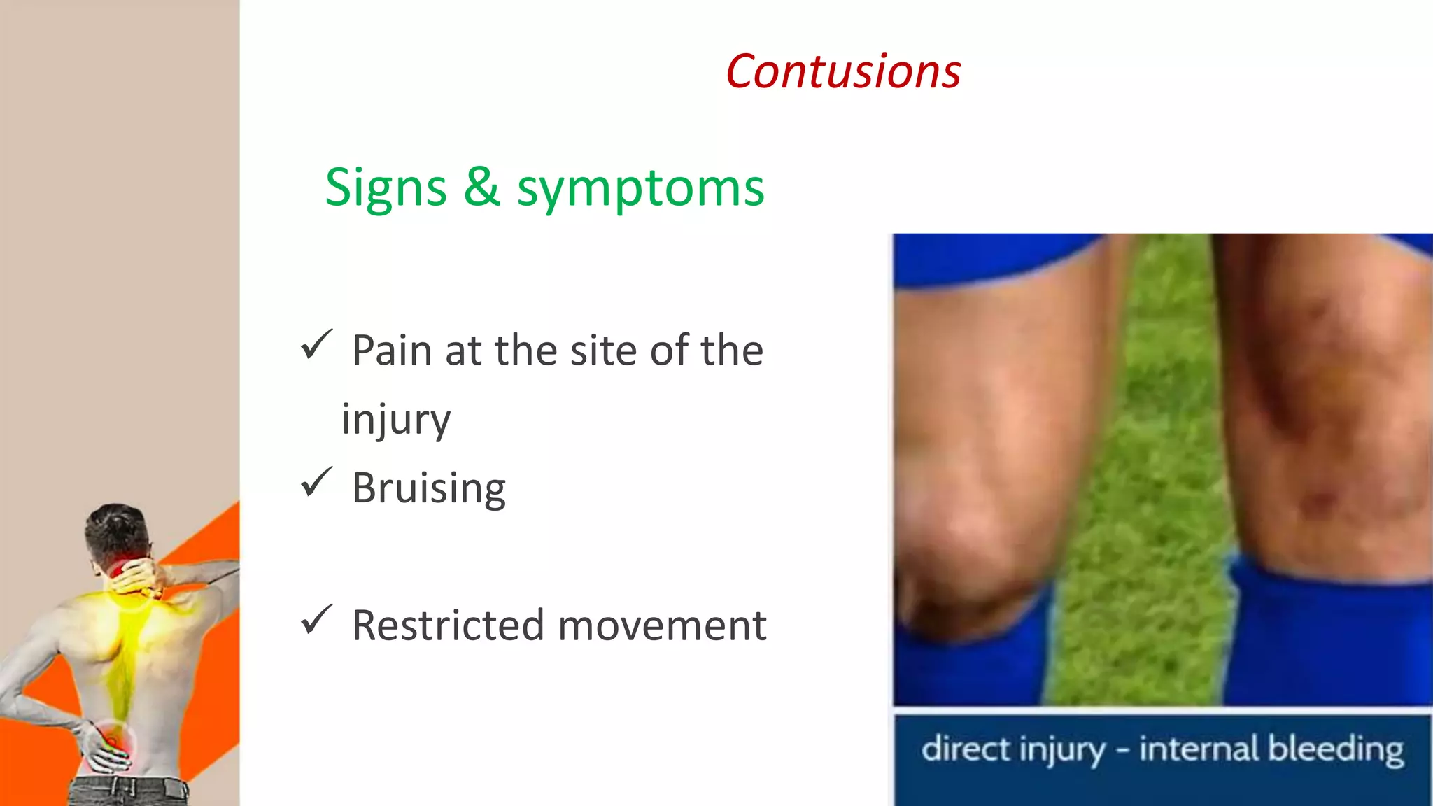 Soft tissue injuries management | PPTX