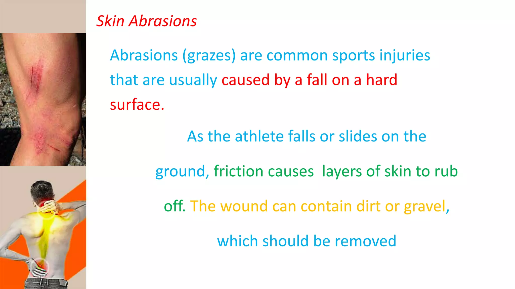 Soft tissue injuries management | PPTX