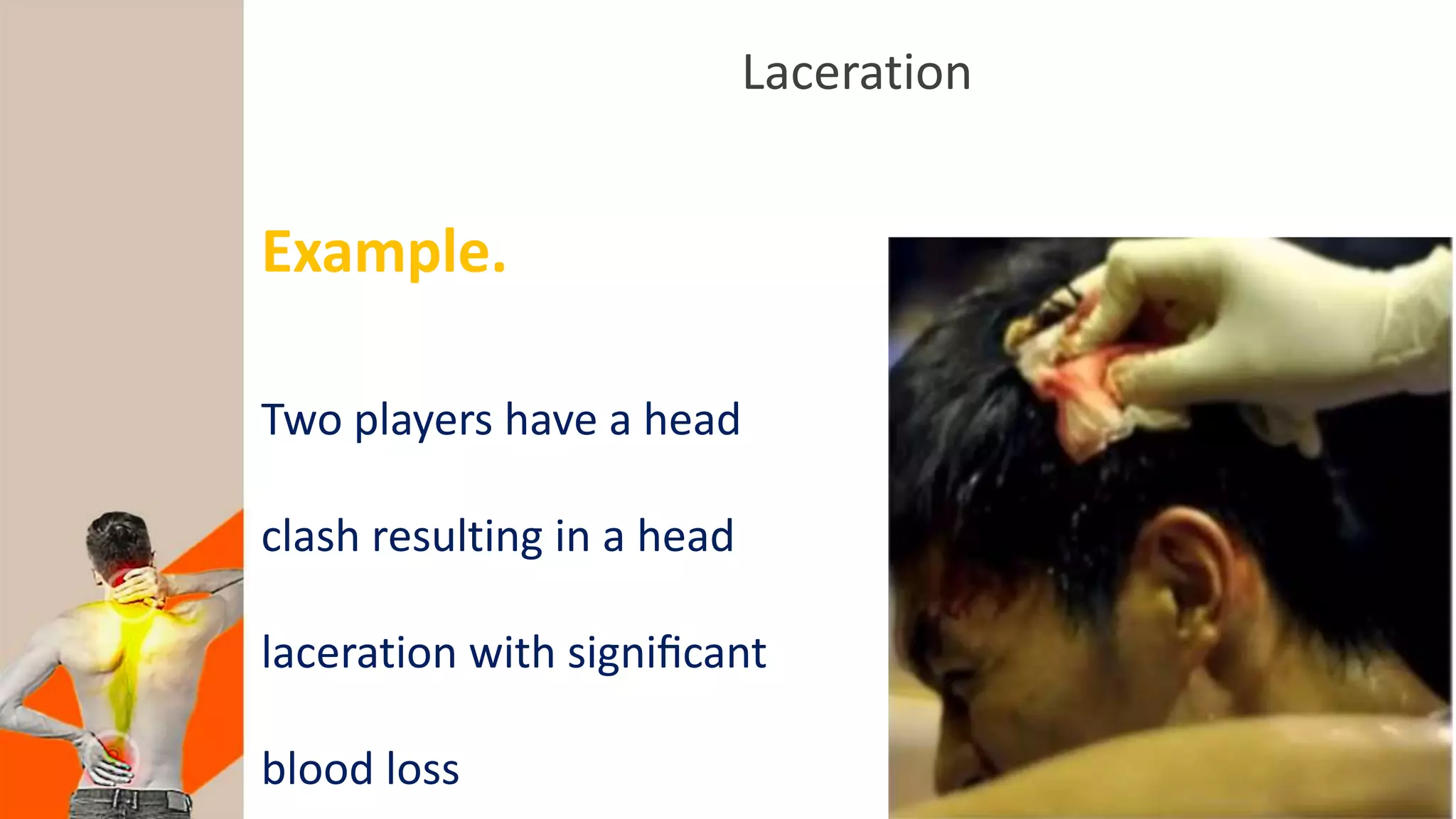 Soft tissue injuries management | PPTX