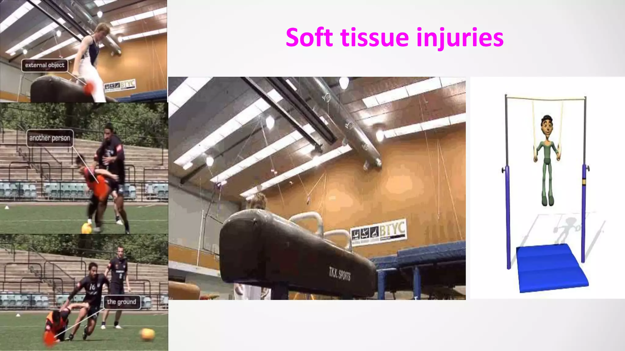 Soft tissue injuries management | PPTX