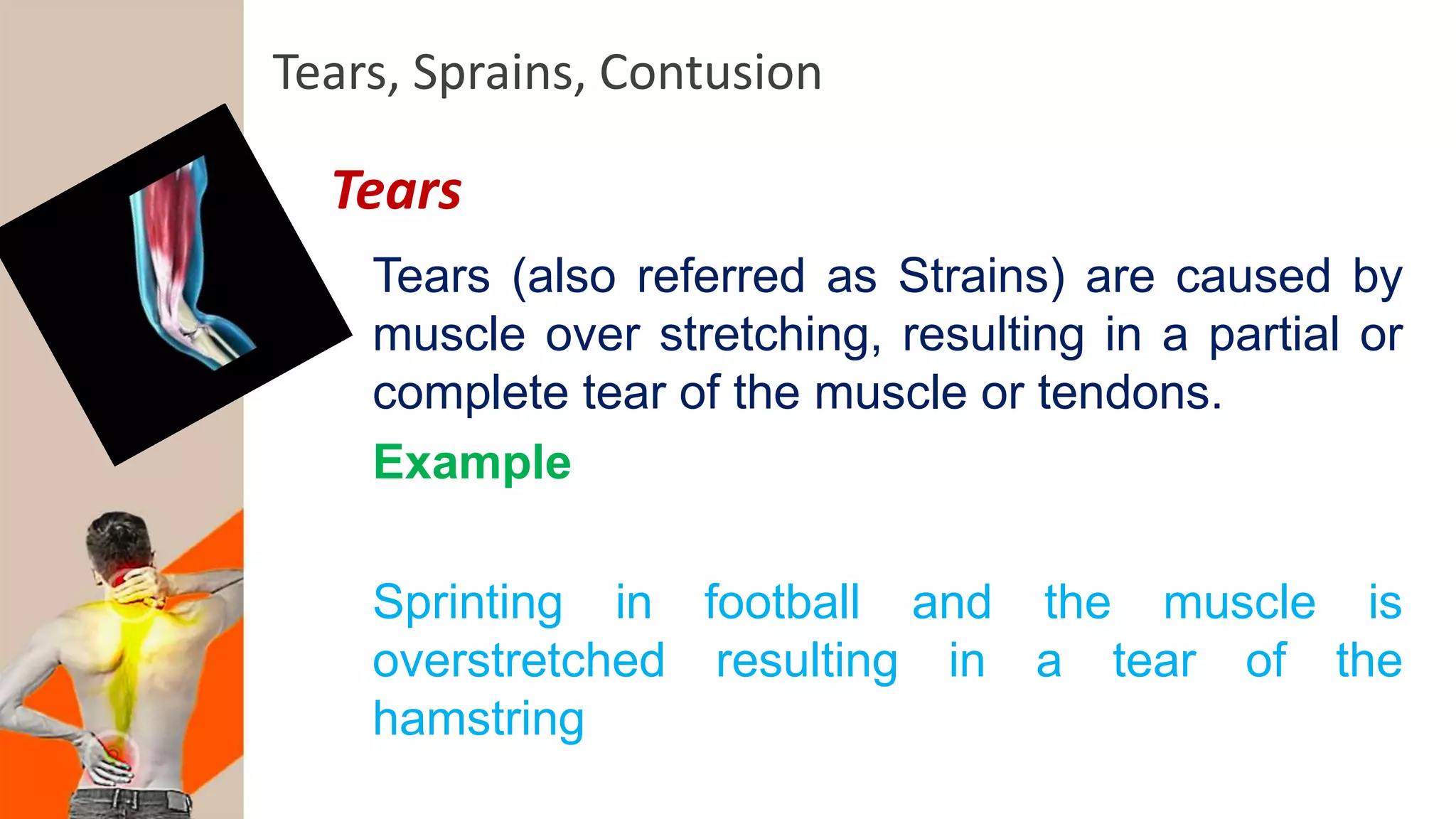 Soft tissue injuries management | PPTX