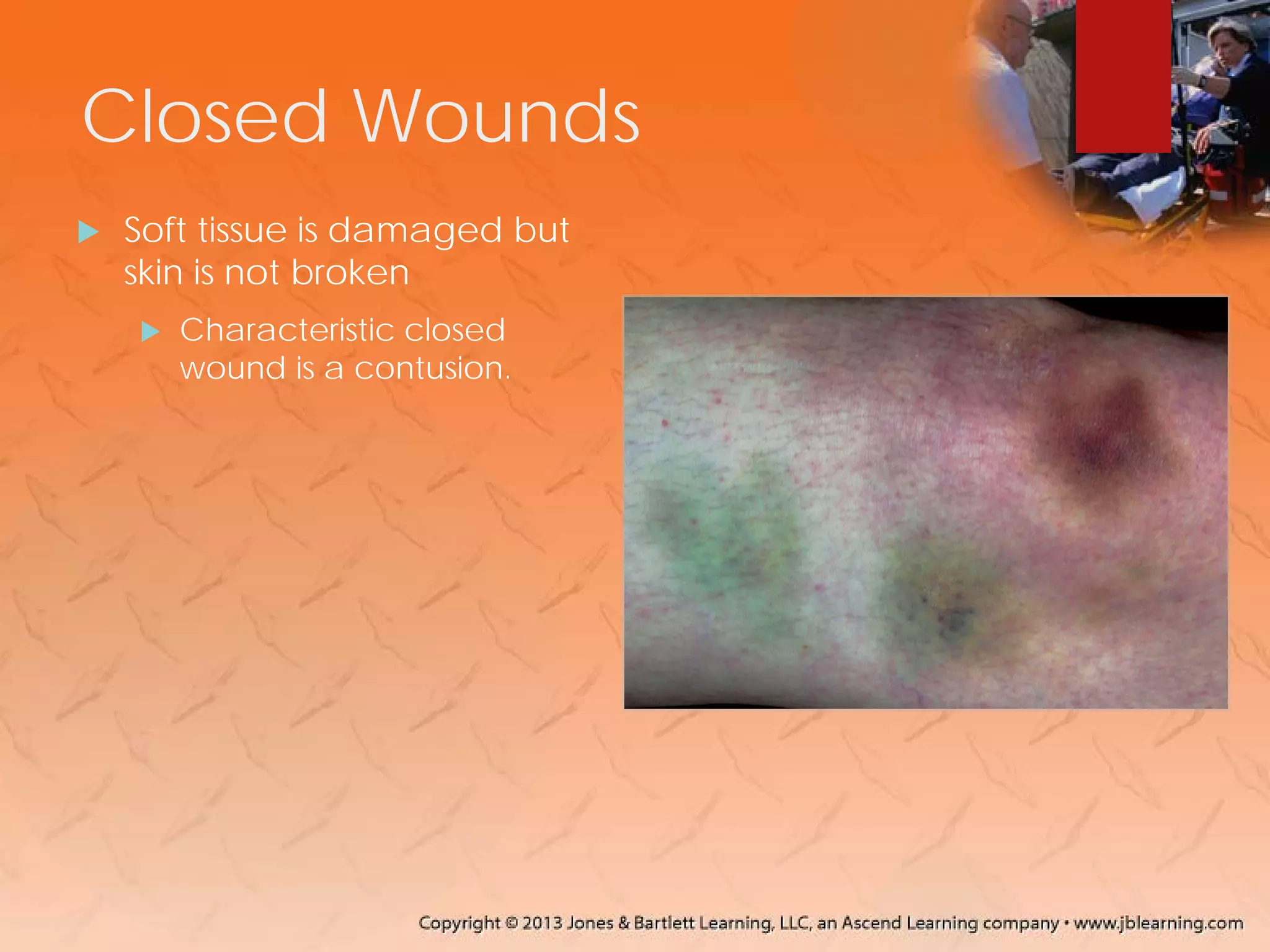 Soft tissue injury | PDF
