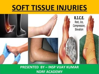 Soft tissue injury | PPT