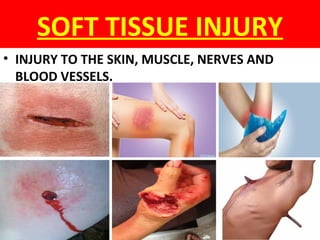 Soft tissue injury | PPT