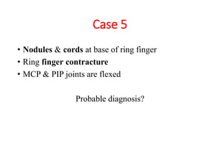Soft tissue affections | PPTX