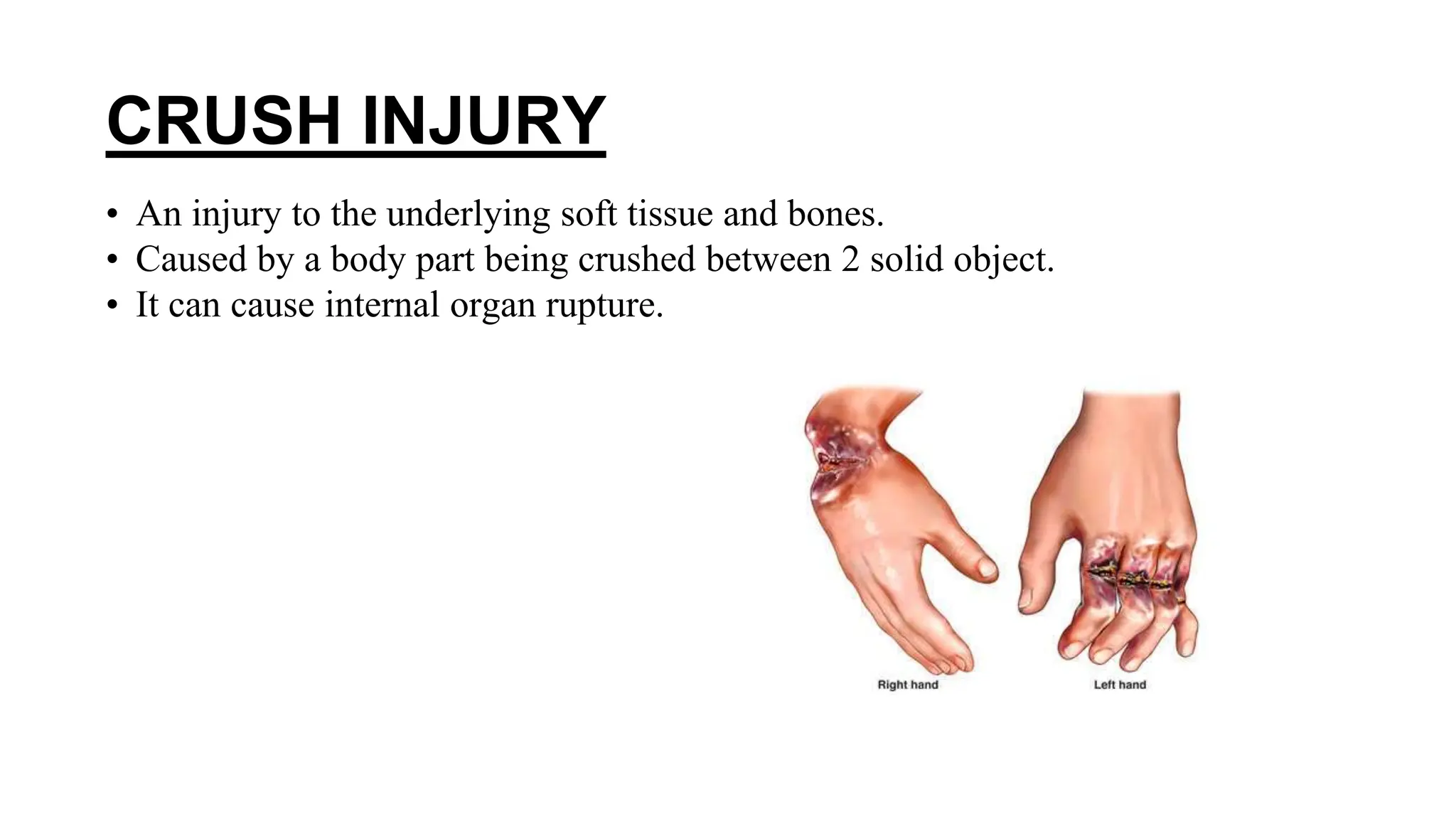 Skin and soft tissue injuries of the human body | PPTX