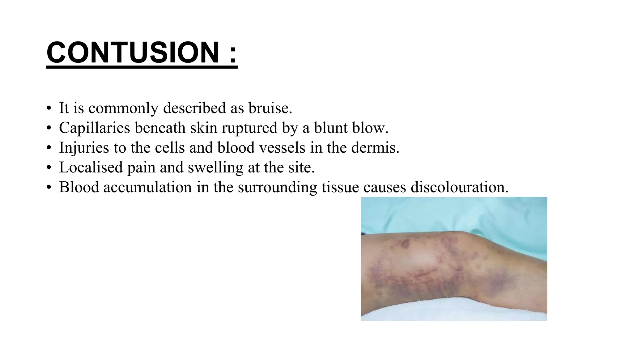 Skin and soft tissue injuries of the human body | PPTX