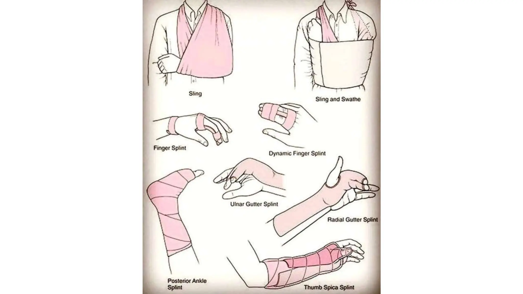 Skin and soft tissue injuries of the human body | PPTX