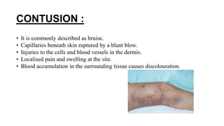 Skin and soft tissue injuries of the human body | PPTX