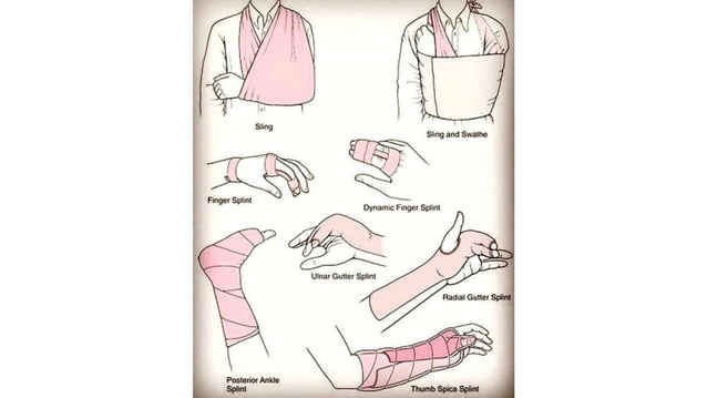 Skin and soft tissue injuries of the human body | PPT