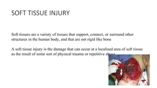 Skin and soft tissue injuries of the human body | PPTX