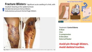 Soft Tissue Injury/Handling in orthopedics. | PPTX