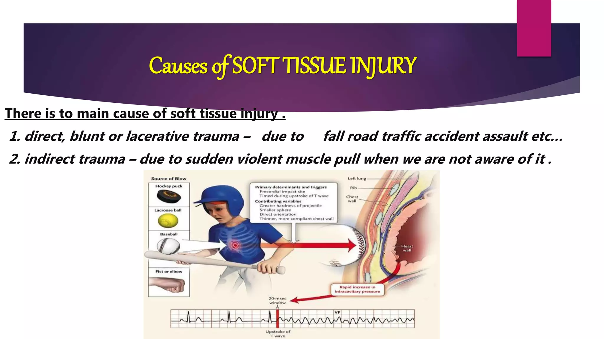Soft tissue injury by MD FURQUAN | PPTX
