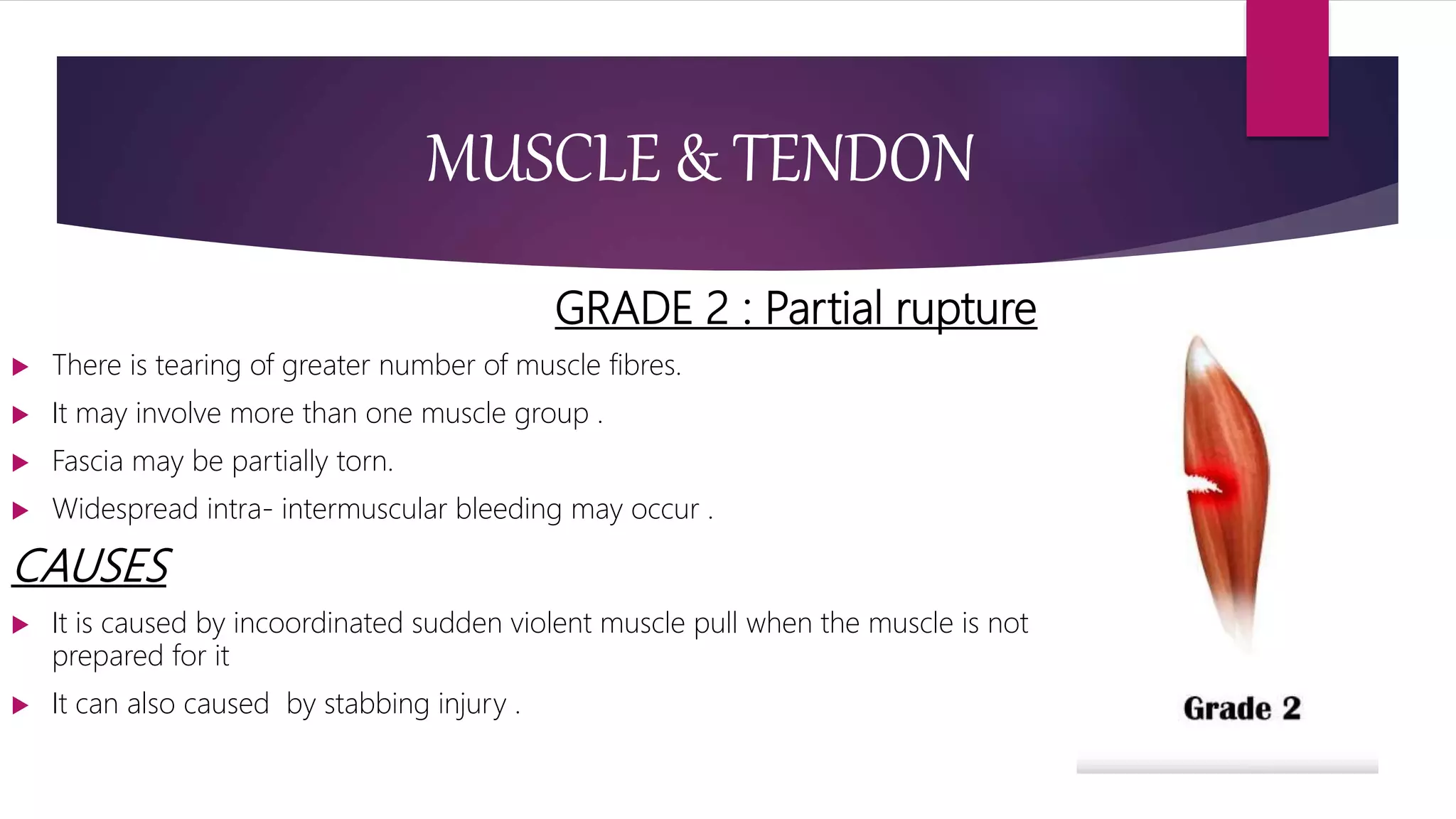 Soft tissue injury by MD FURQUAN | PPTX