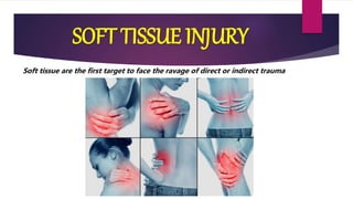 Soft tissue injury by MD FURQUAN | PPTX
