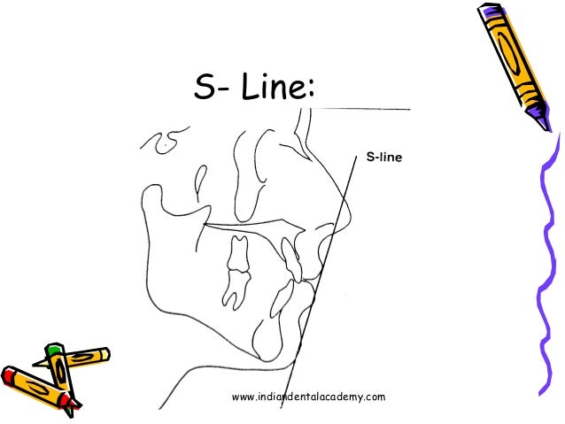 Soft tissue land marks /certified fixed orthodontic courses by Indian…