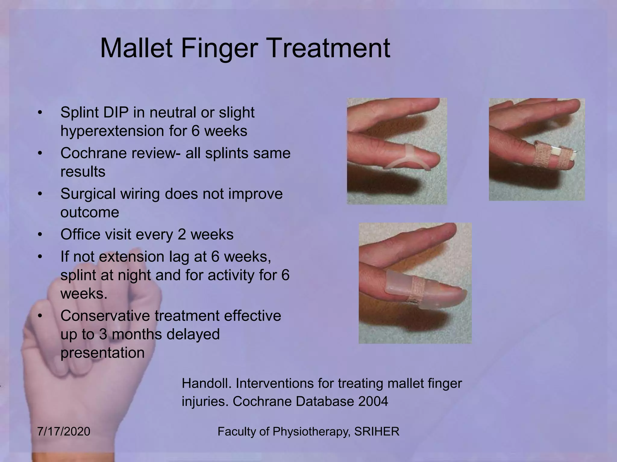 Soft tissue lesion hand | PPTX