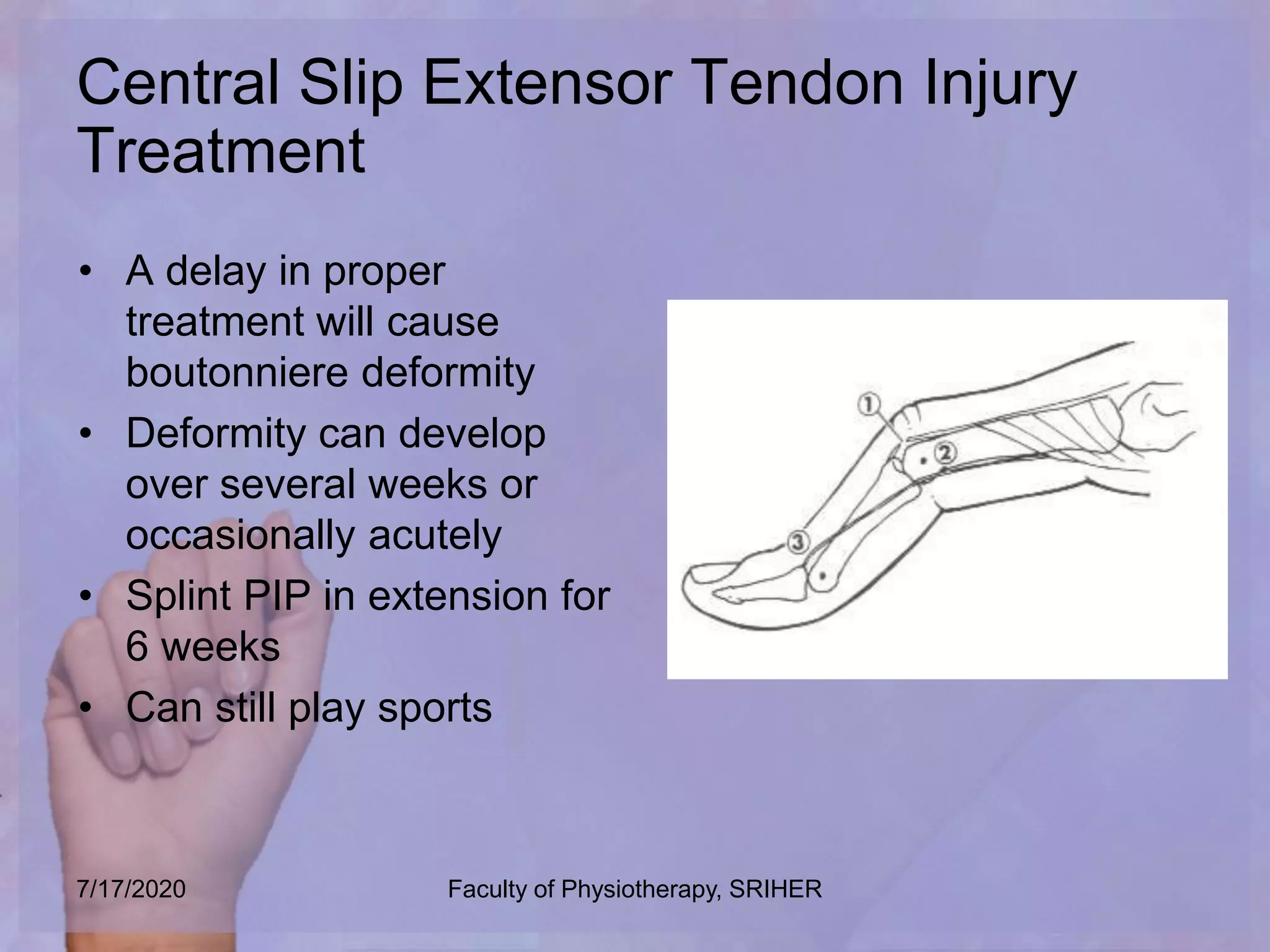 Soft tissue lesion hand | PPTX